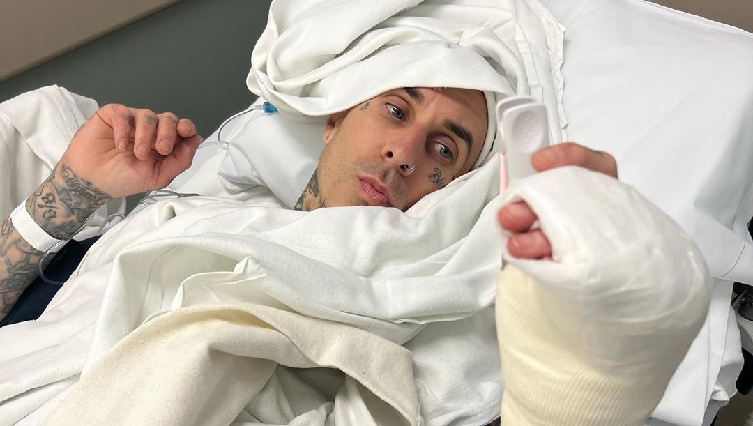 Travis Barker grabo tres nuevas canciones de Blink-182 con el dedo roto ...